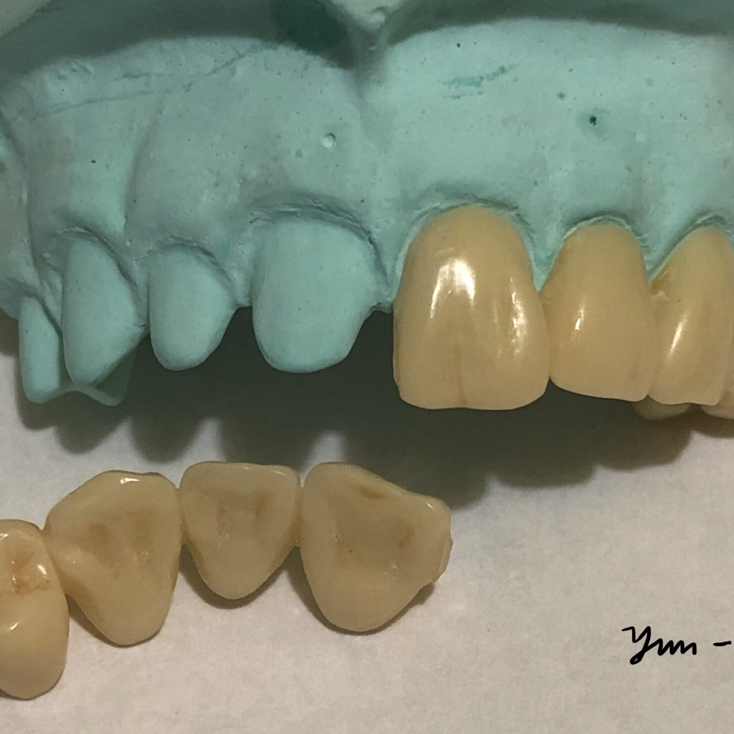 Crown & Bridge - WK Dental Ceramics